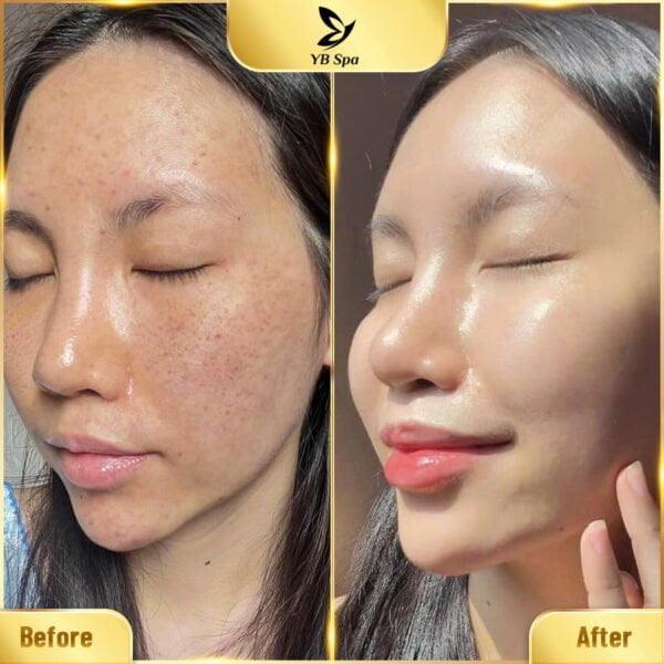 Viện Thẩm Mỹ YB Spa