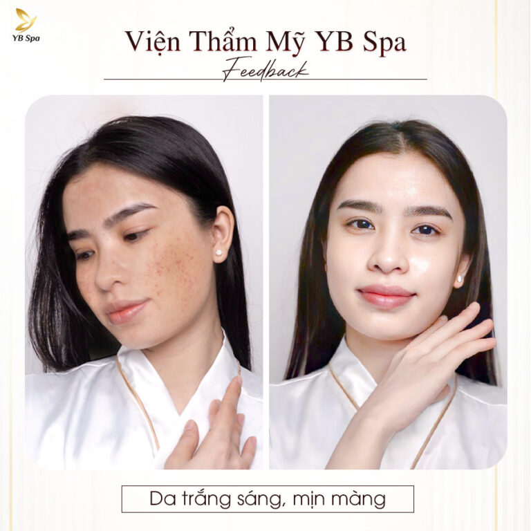 Viện Thẩm Mỹ YB Spa