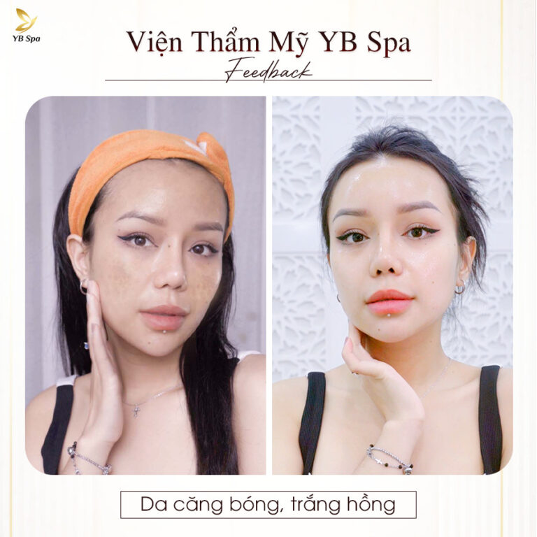 Viện Thẩm Mỹ YB Spa