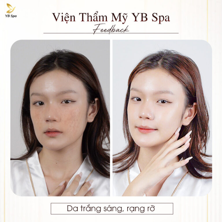 Viện Thẩm Mỹ YB Spa